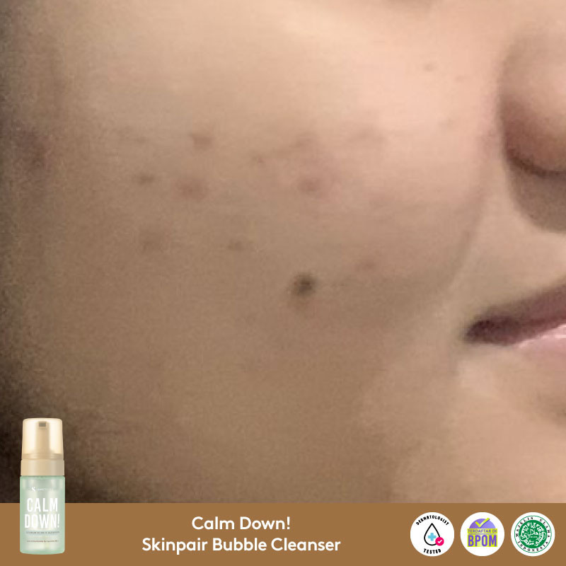 Buy SOMETHINC Calm Down! Skinpair Bubble Cleanser Original Best Deals