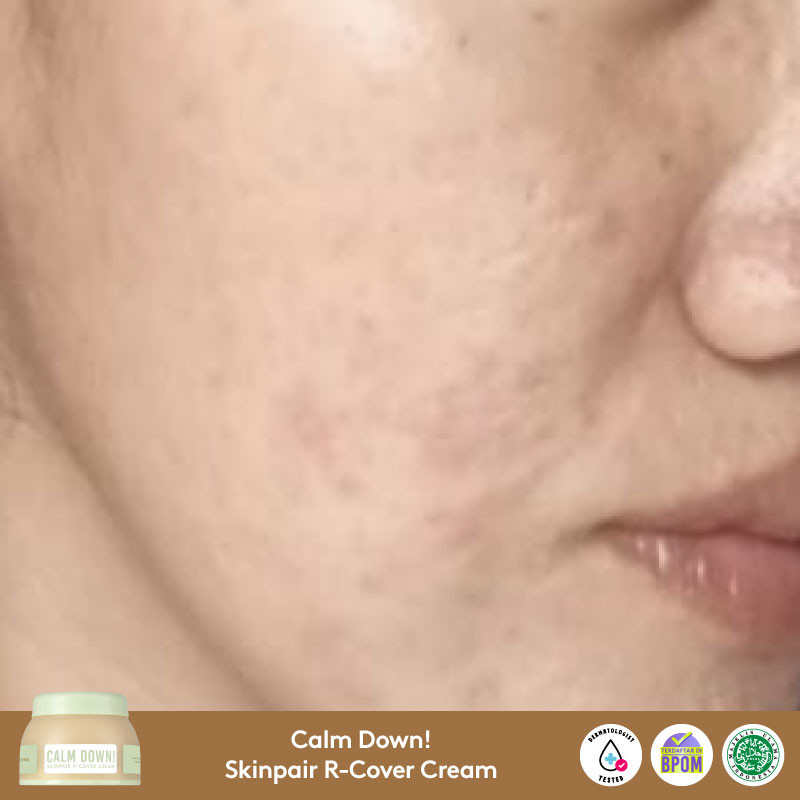 Buy SOMETHINC Calm Down! Skinpair R-Cover Cream Original Best Deals